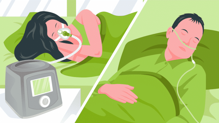 Sleep Apnea Side Effects & Symptoms - CPAPSupply.ca