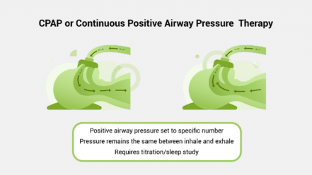 CPAP Supply Glossary: 20 Essential CPAP Terms Every Canadian Needs to Know